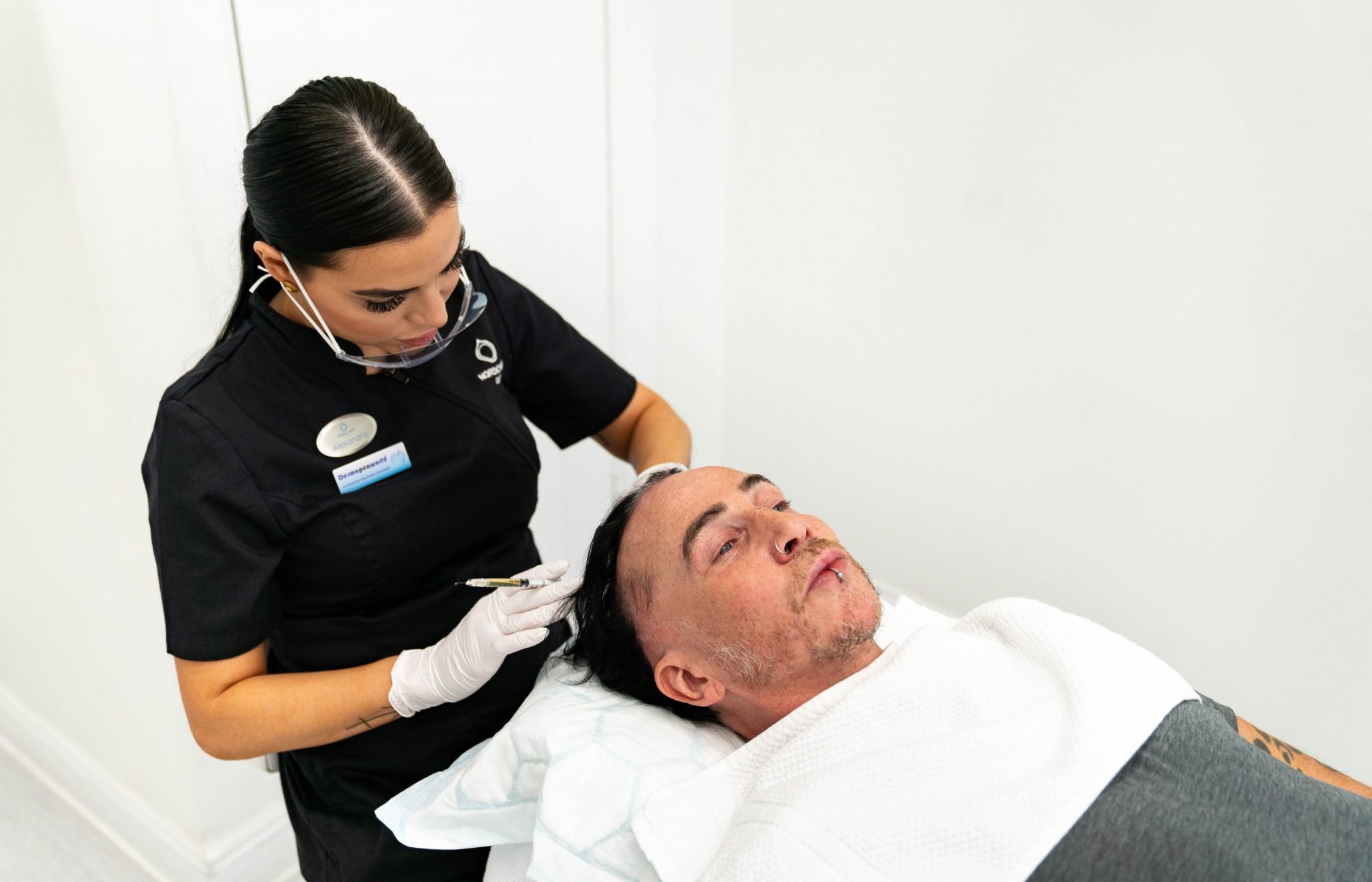 Alopecia Areata - the disease that causes patchy hair loss – Nordic Hair