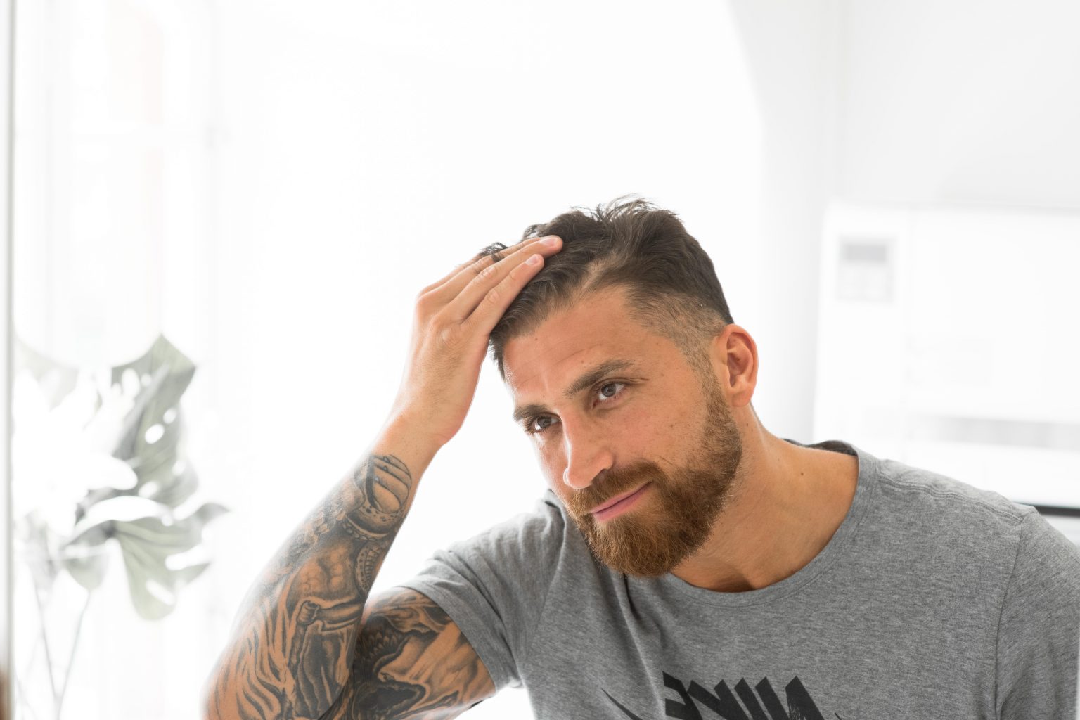 Alopecia – alopeci och håravfall – Nordic Hair